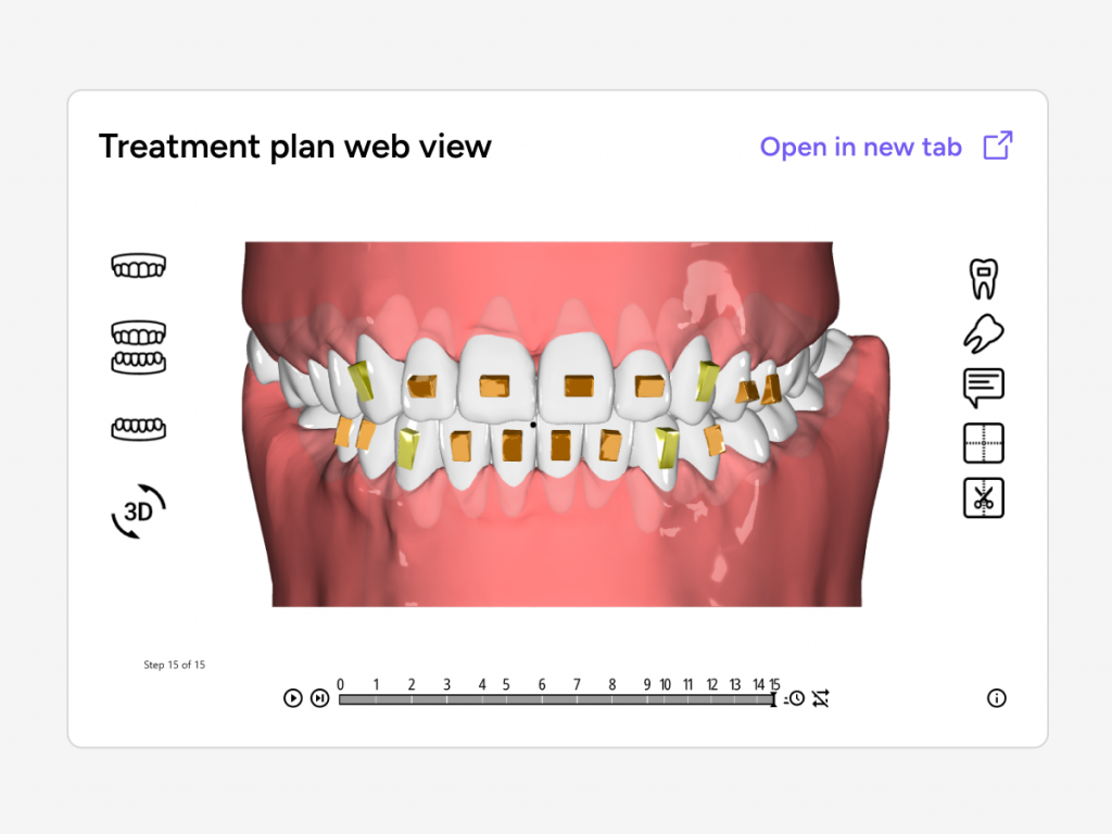 For Aligner Companies